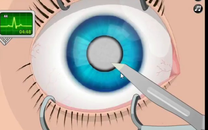 【童年向】眼部手术小游戏