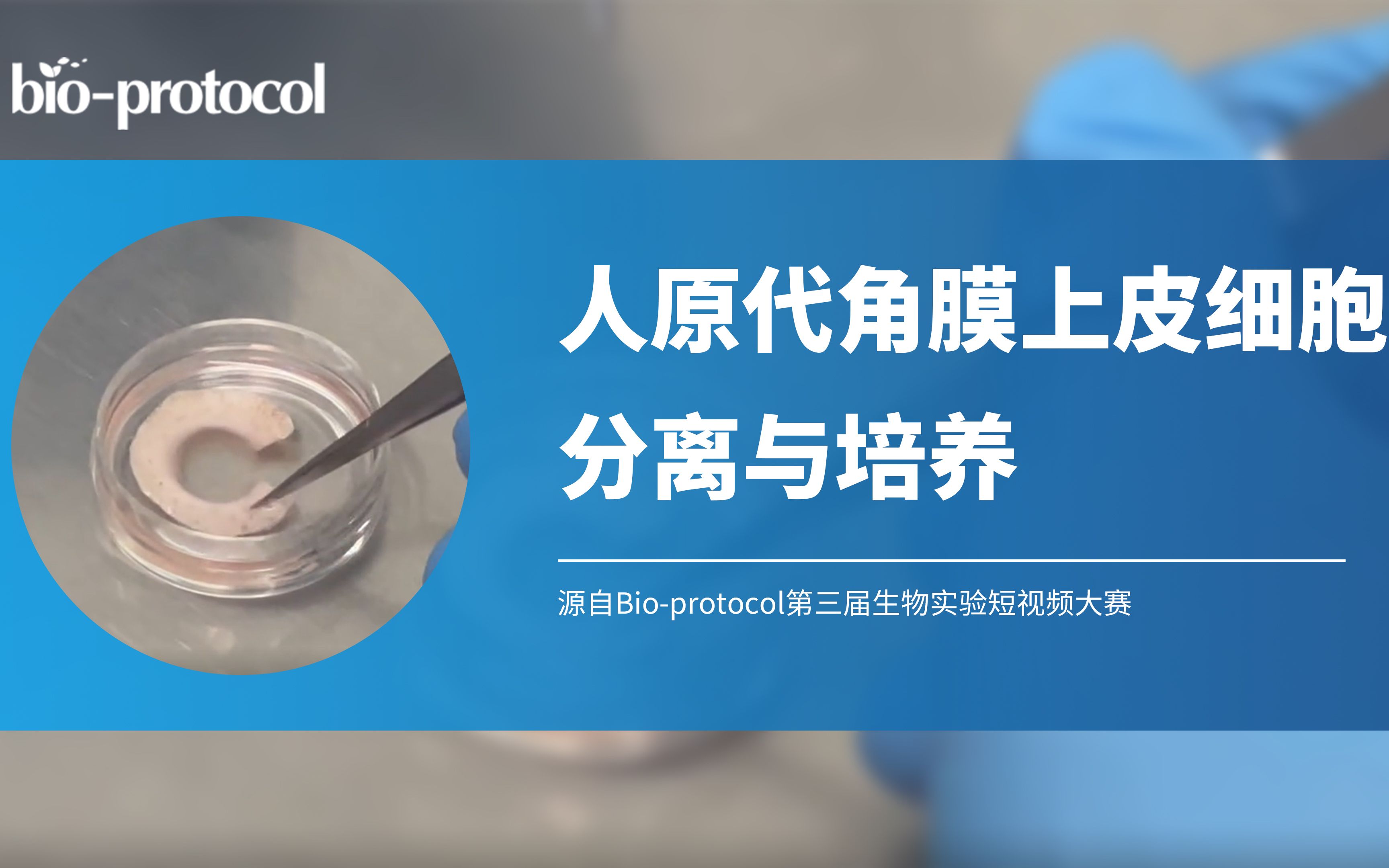 【短视频大赛】培养的人角膜上皮细胞已成功用于角膜重建?快来学习...