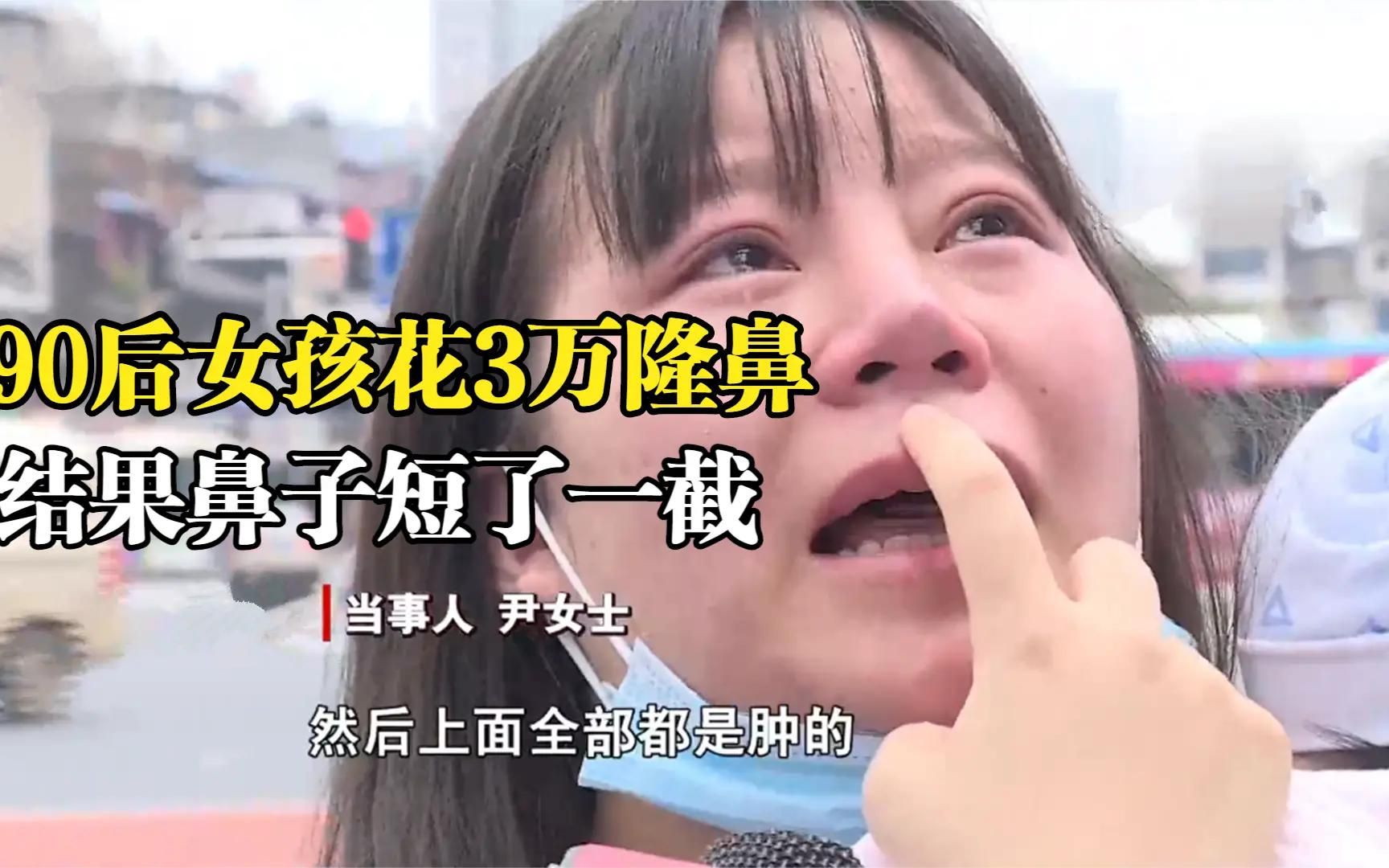 90后女孩花3万隆鼻,结果鼻子短了一截,医生:没法修复了