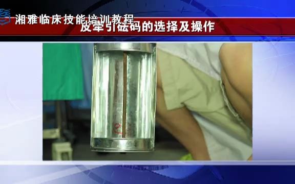 视频2-2-3a:皮牵引砝码的选择及操作