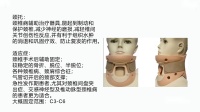 20210226 矫形器的使用 王健