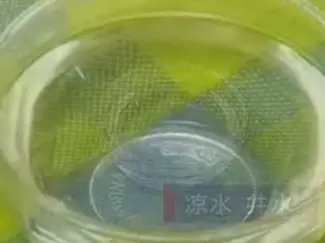 中医推拿疗法 第一集 中医推拿的基础知识