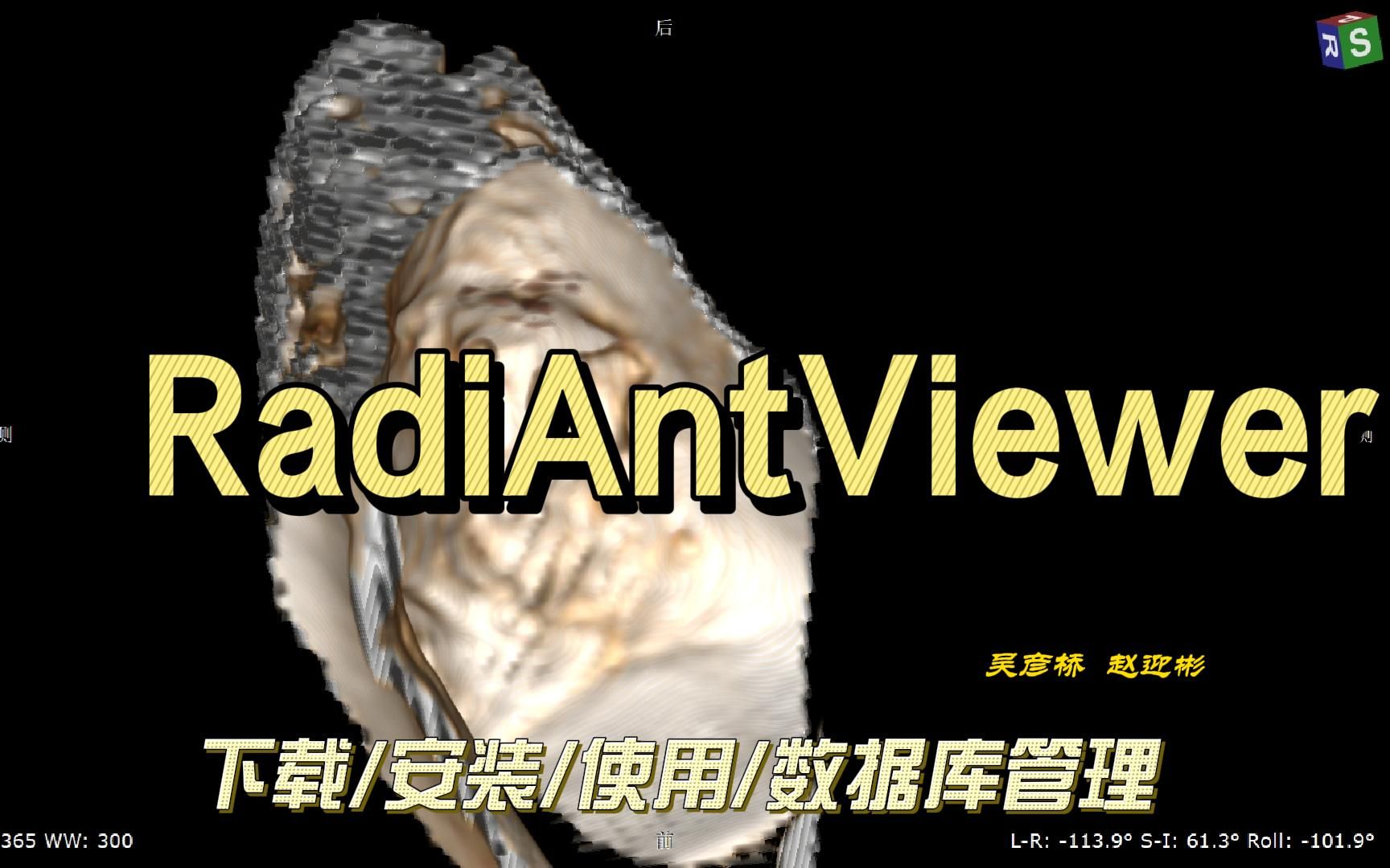 RadiAntDicomViewer下载安装使用及数据库管理教程