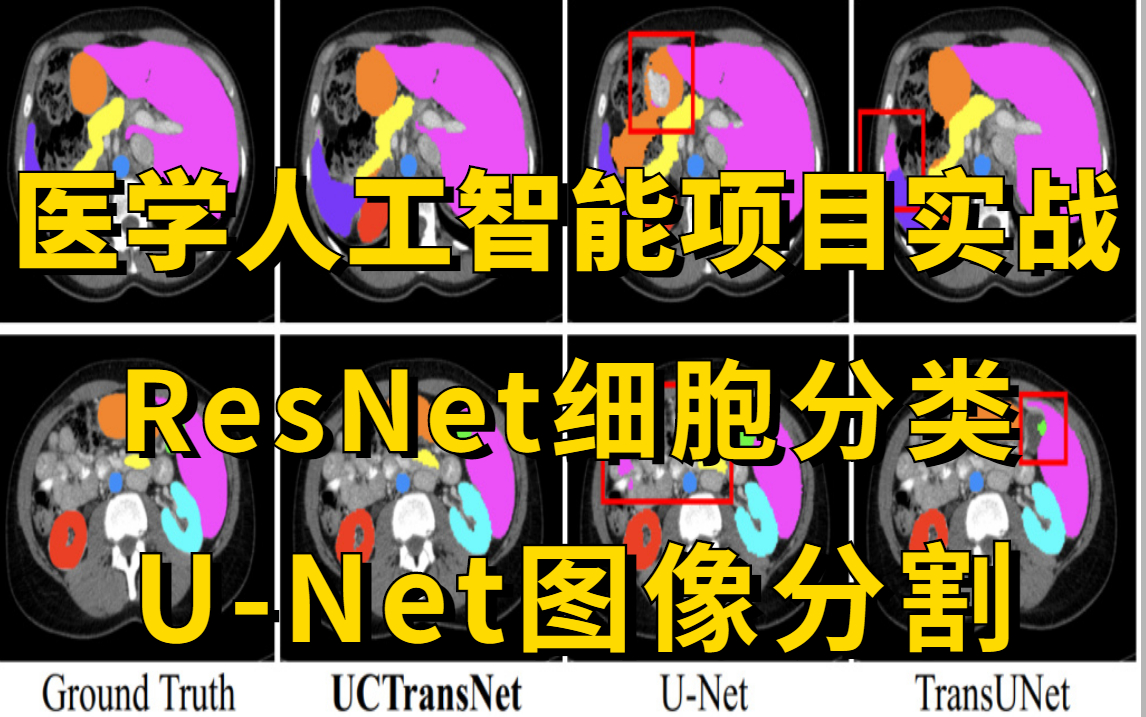 两大医学人工智能项目实战:基于ResNet网络的细胞分类实战+基于U-...