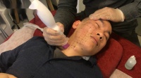 康少林单极射频 玛吉使用教学视频,不是市场普通便宜的双极射频热玛吉