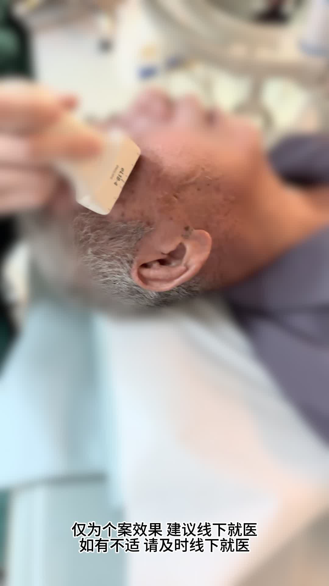 老人家拨牙后脸上长肿块!#超声介入 #超声科日常分享 #甲状腺 #淋巴...