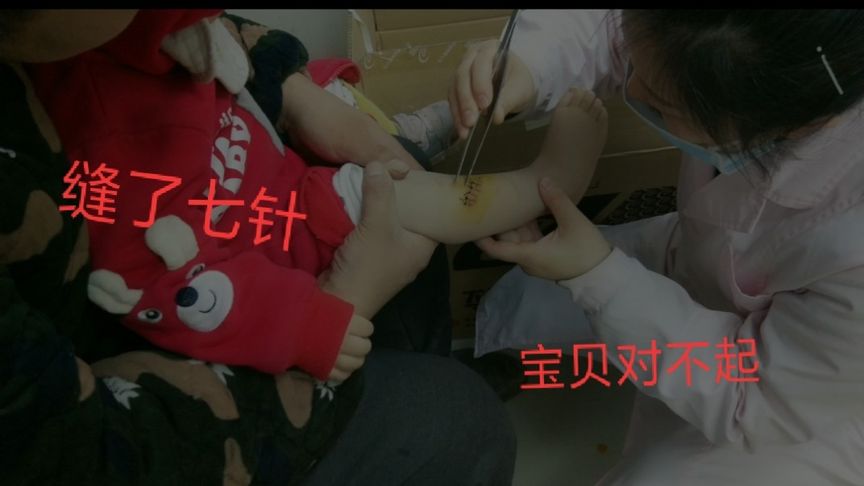 14个月宝宝被刀伤到,拆线时宝宝没哭但眼里写着恐惧,宝贝对不起