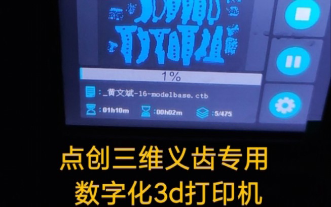 3d打印口扫模型,代替传统石膏取模,方便快捷,更高效!
