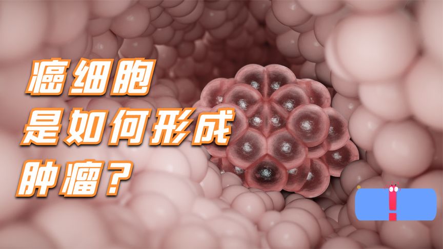 【疾病的奥秘】:3D还原--肿瘤的形成过程