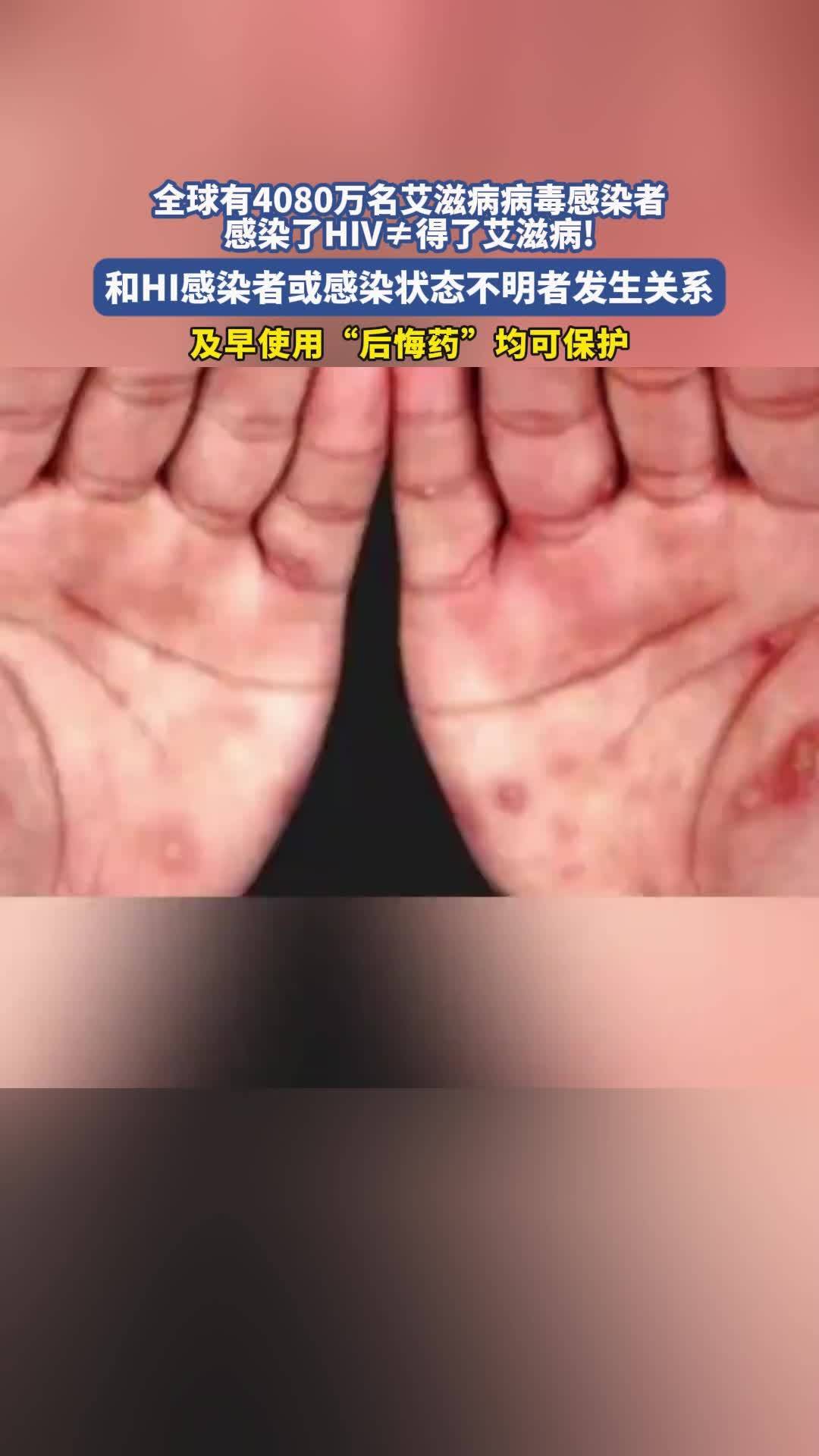 全球有4080万名艾滋病病毒感染者,感染了HIV≠得了艾滋病