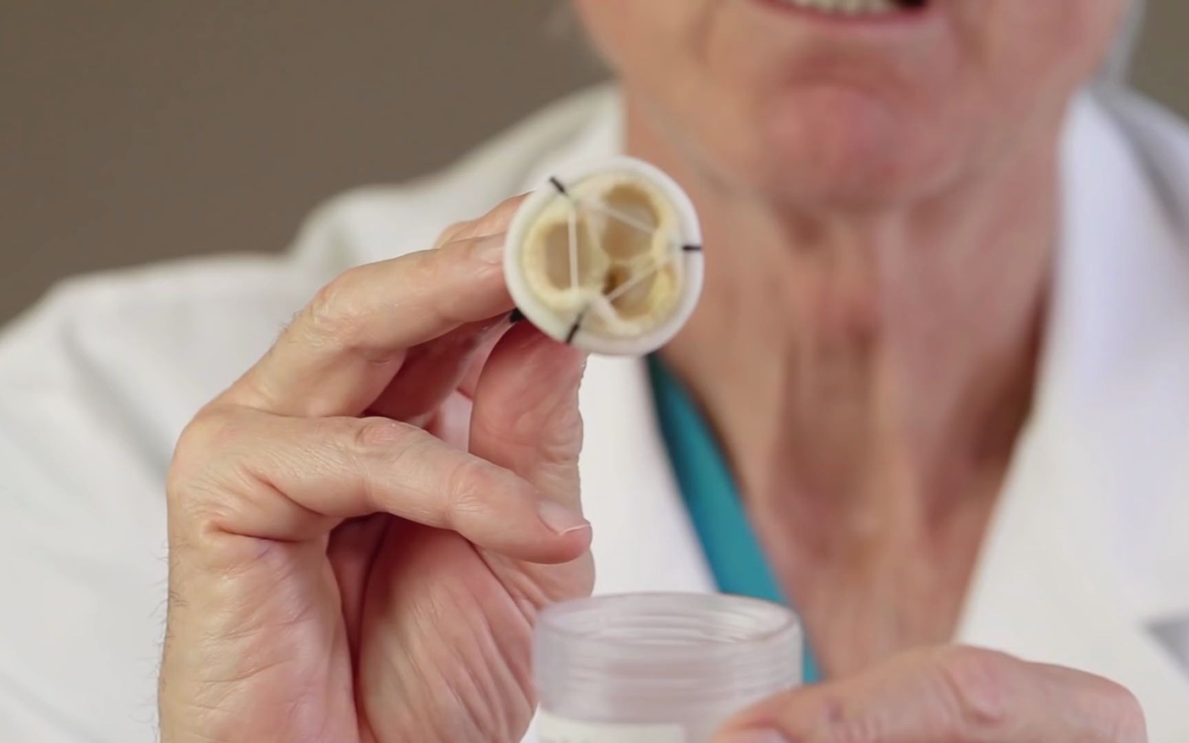 心脏瓣膜置换术:心脏瓣膜的选择