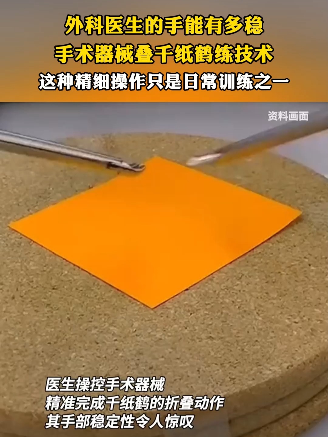 外科医生的手能有多稳,手术器械叠千纸鹤练技术