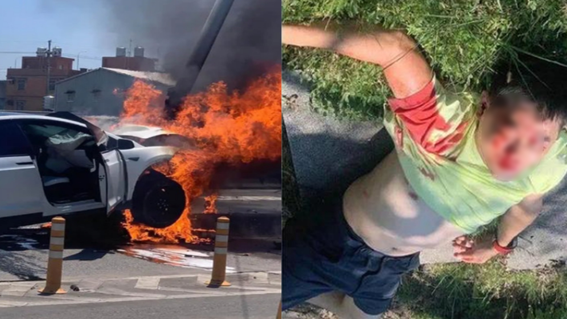 林志颖疑似颅内出血,车祸致颜面骨折或将做整容手术:脸部3D重建