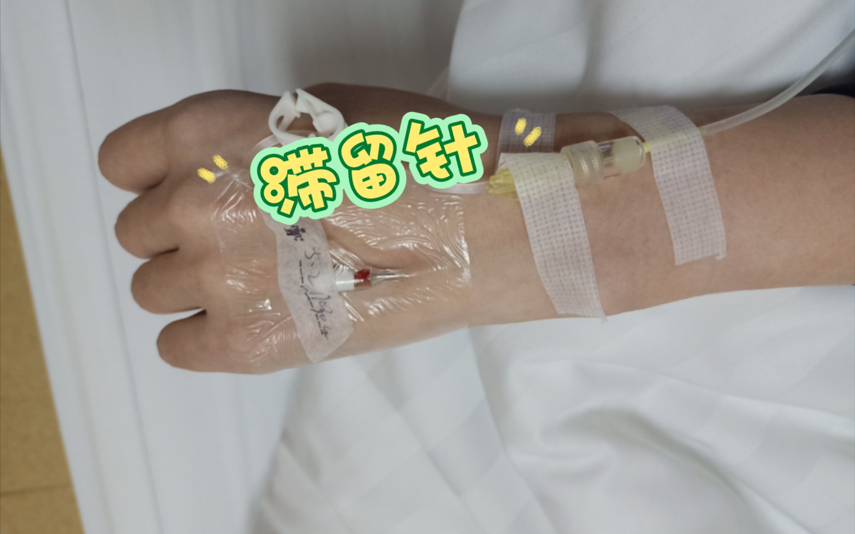 住院Vlog4晚八点半黄金时段小惊喜-扎上滞留针啦-明天还有针-圆子日常
