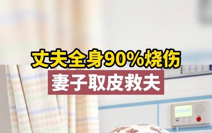 丈夫全身90%烧伤,妻子取皮救夫