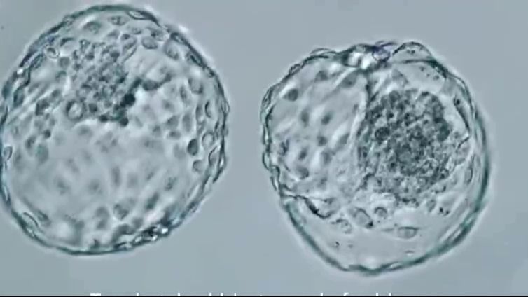 2枚漂亮的6AA囊胚,等待三代试管筛查取样,希望有个好结果