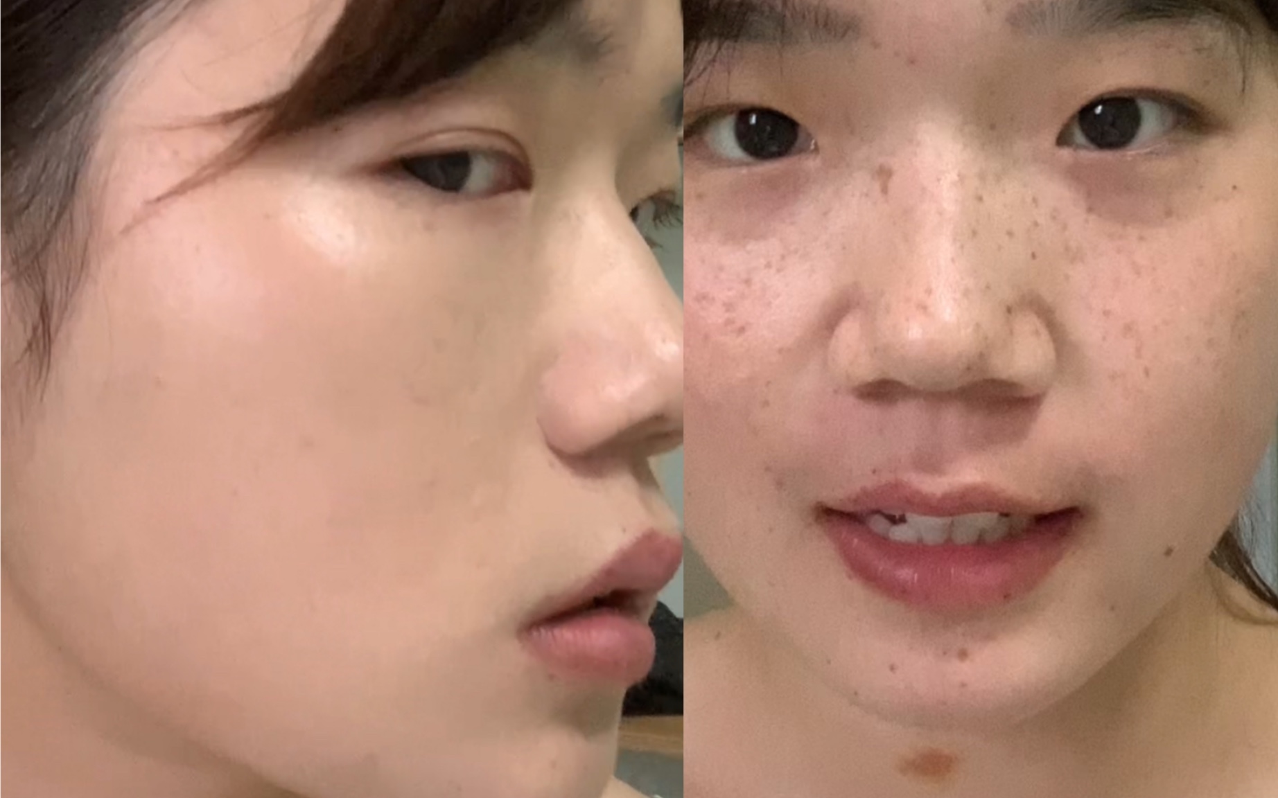 暑假变美计划之最简单遮雀斑!你敢信这是同一个人!