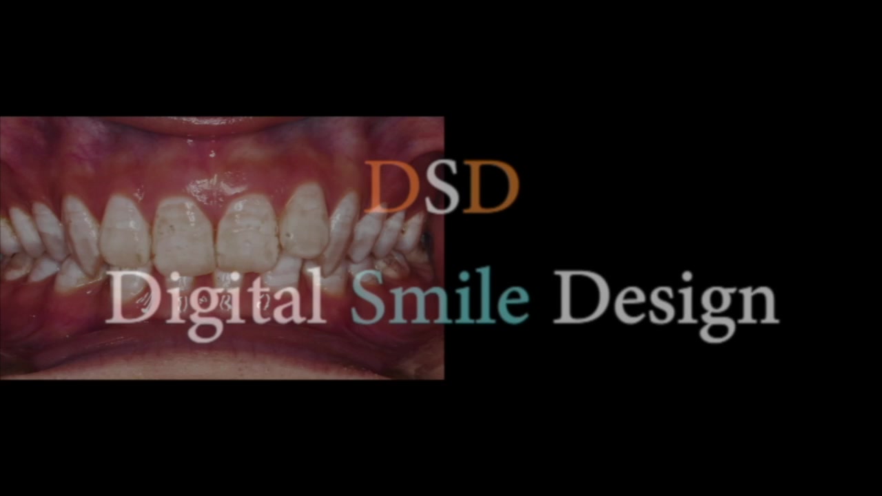 D4口腔美学-DSD数字微笑设计