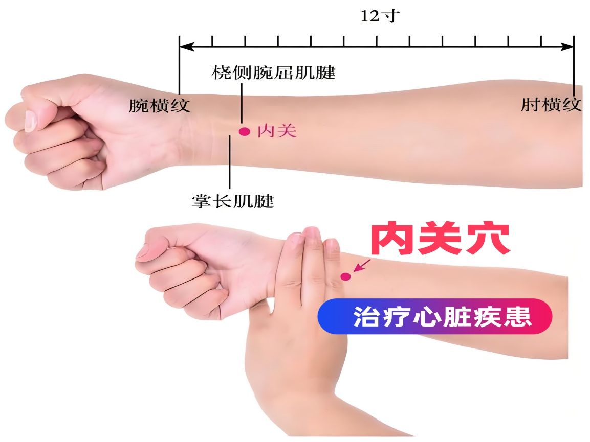 150、手厥阴心包经 — 内关穴 — 治疗心脏疾患