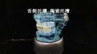 君晓天云牙齿牙科正畸四种託槽对比展示模型口腔模型牙科矫正牙模...