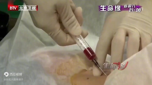 医生把孕妇的腹部打开时,让所有人都没想到的事情,发生了