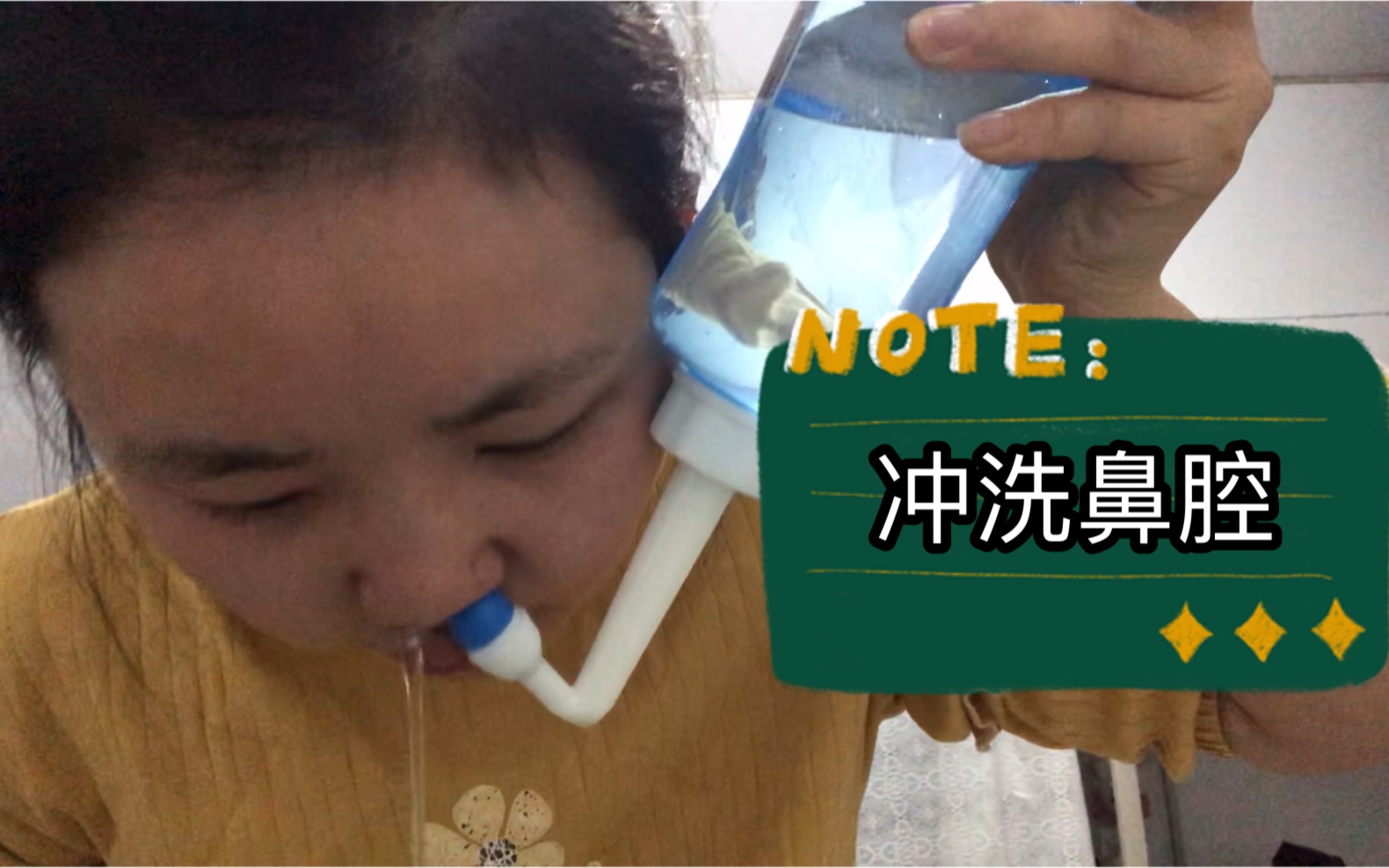 鼻炎患者第一次使用鼻腔冲洗器