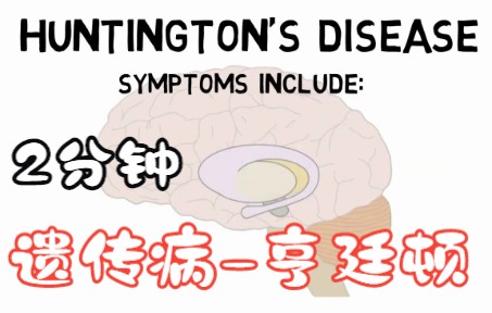 【中英文-10】2分钟神经疾病-亨廷顿病@脑壳痛疼