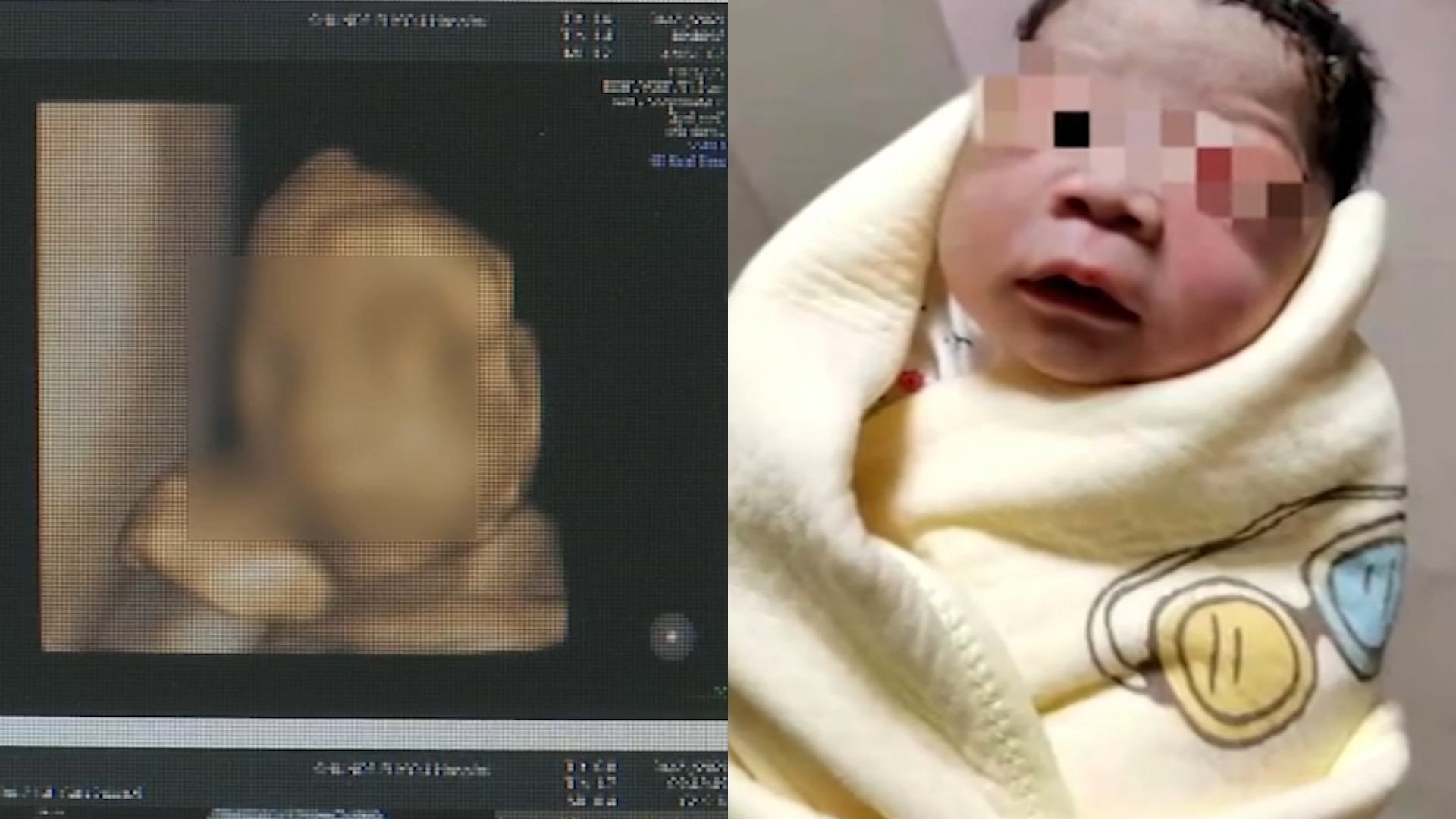 大女儿独立后内心“空虚”,53岁妈妈追生二胎,做试管喜得一子