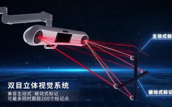 手术导航 手术定位 近红外双目视觉 (手术机器人整体解决方案提供商)...