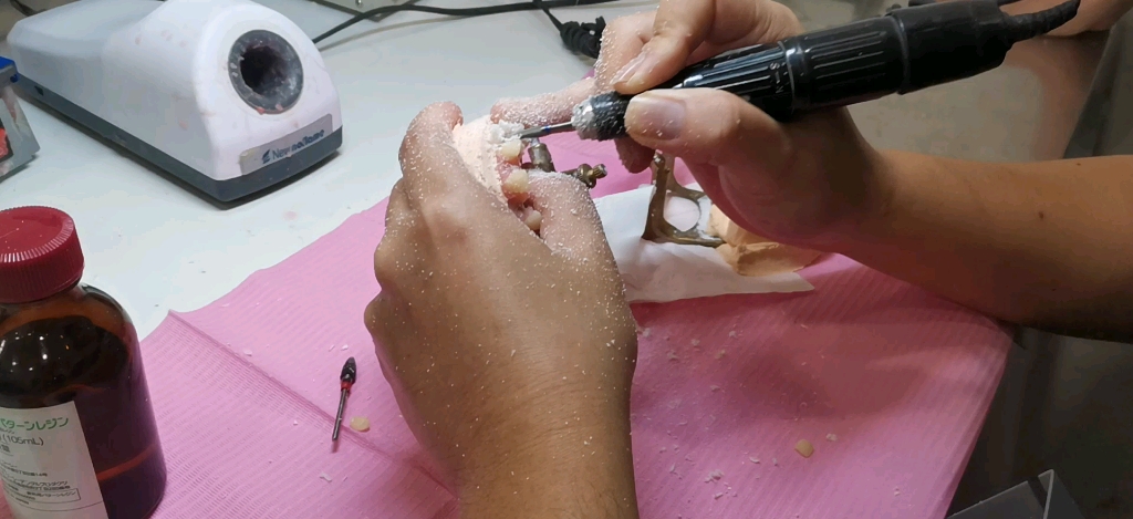 牙科手艺人—即刻负重