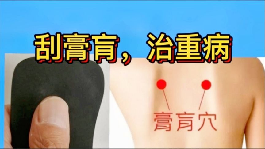 膏肓穴:止痛散寒、能力挽沉疴的大穴。