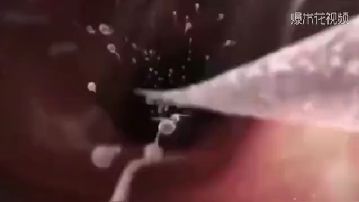 视频很生动的全释了,我们人类生命诞生的伟大过程。