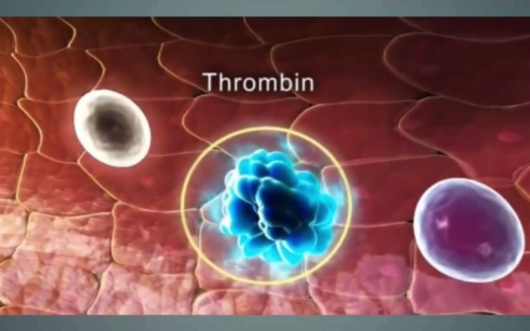 3D医学动画:血液凝固的发生机制
