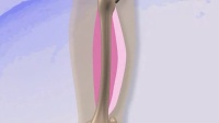新生儿肌肉注射