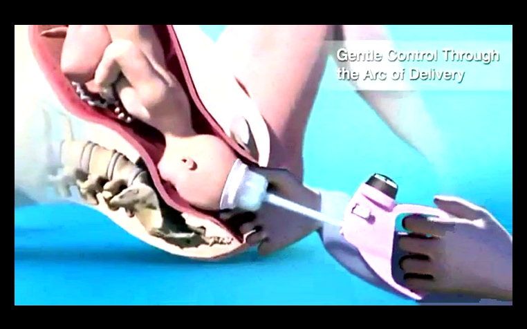 3D动画诠释:女人顺产分娩全过程,妈妈真是伟大