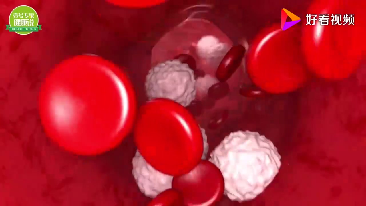 肝癌和白血病都有同一个信号,皮肤上出现这个“标志”,请小心