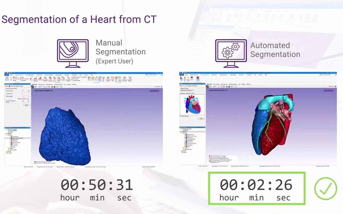 【Simpleware】儿童心脏模型的3D打印:心脏3D结构的自动化图像分割...