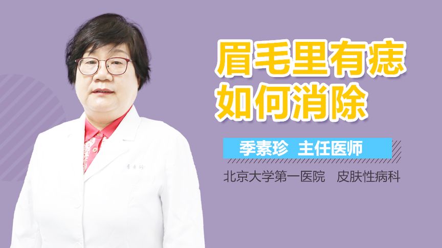 怎么才能把眉毛里的痣去掉?选择适合自己的方法#健康知多少#