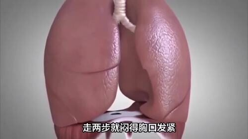 5个无器械强肺动作 30天告别爬楼喘戴口罩闷