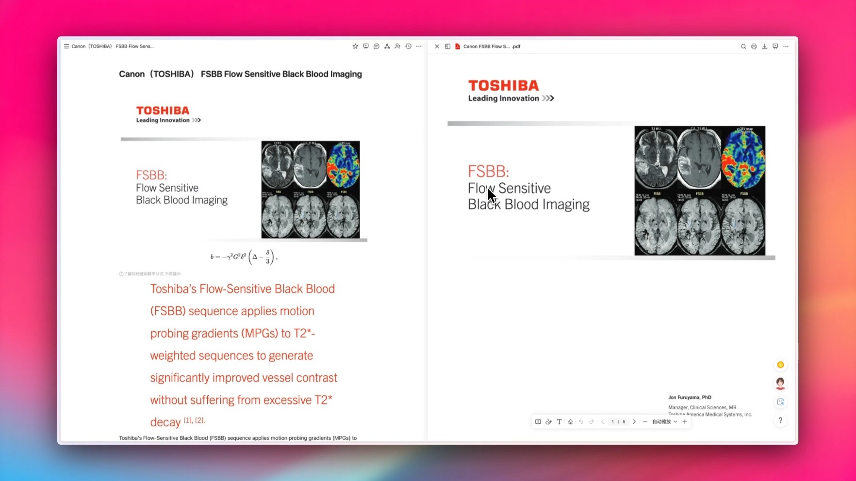 FSBB(血流敏感黑血成像)技术解读(使用DeepSeek-R1,wolai笔记)