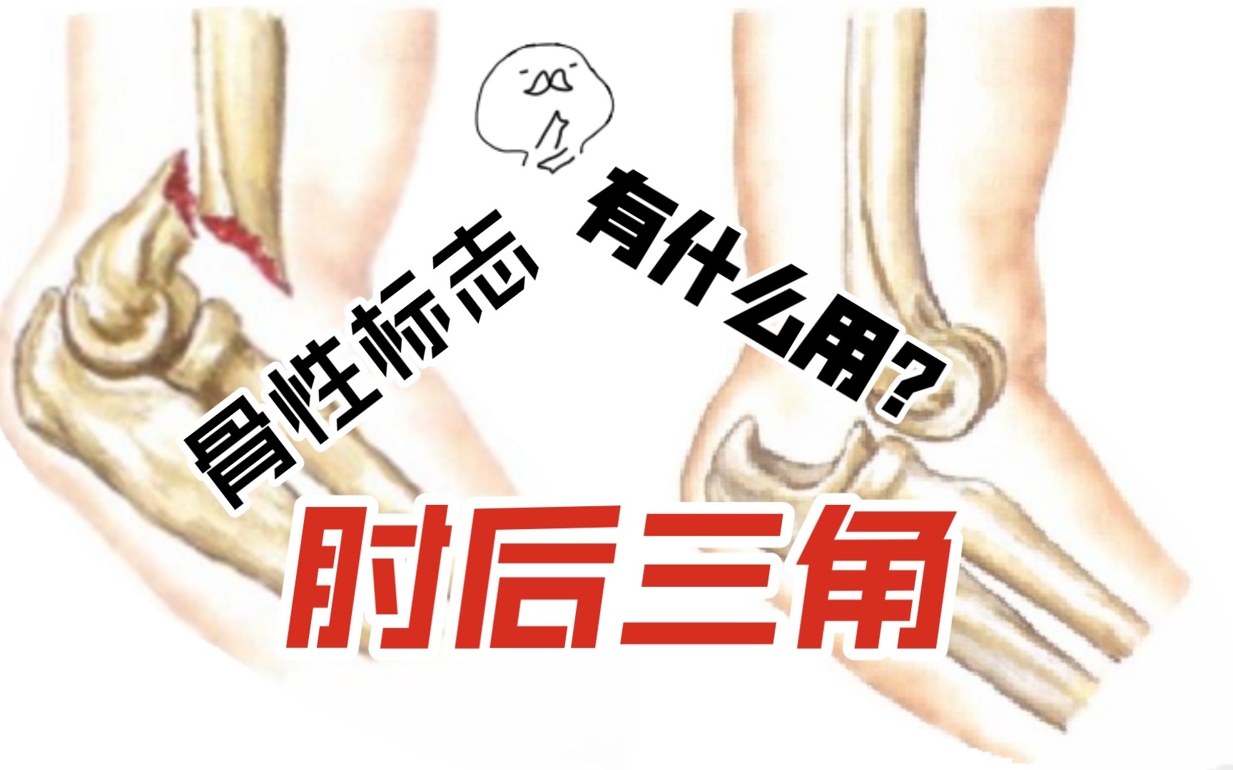 骨伤科特殊体格检查28:肘后三角