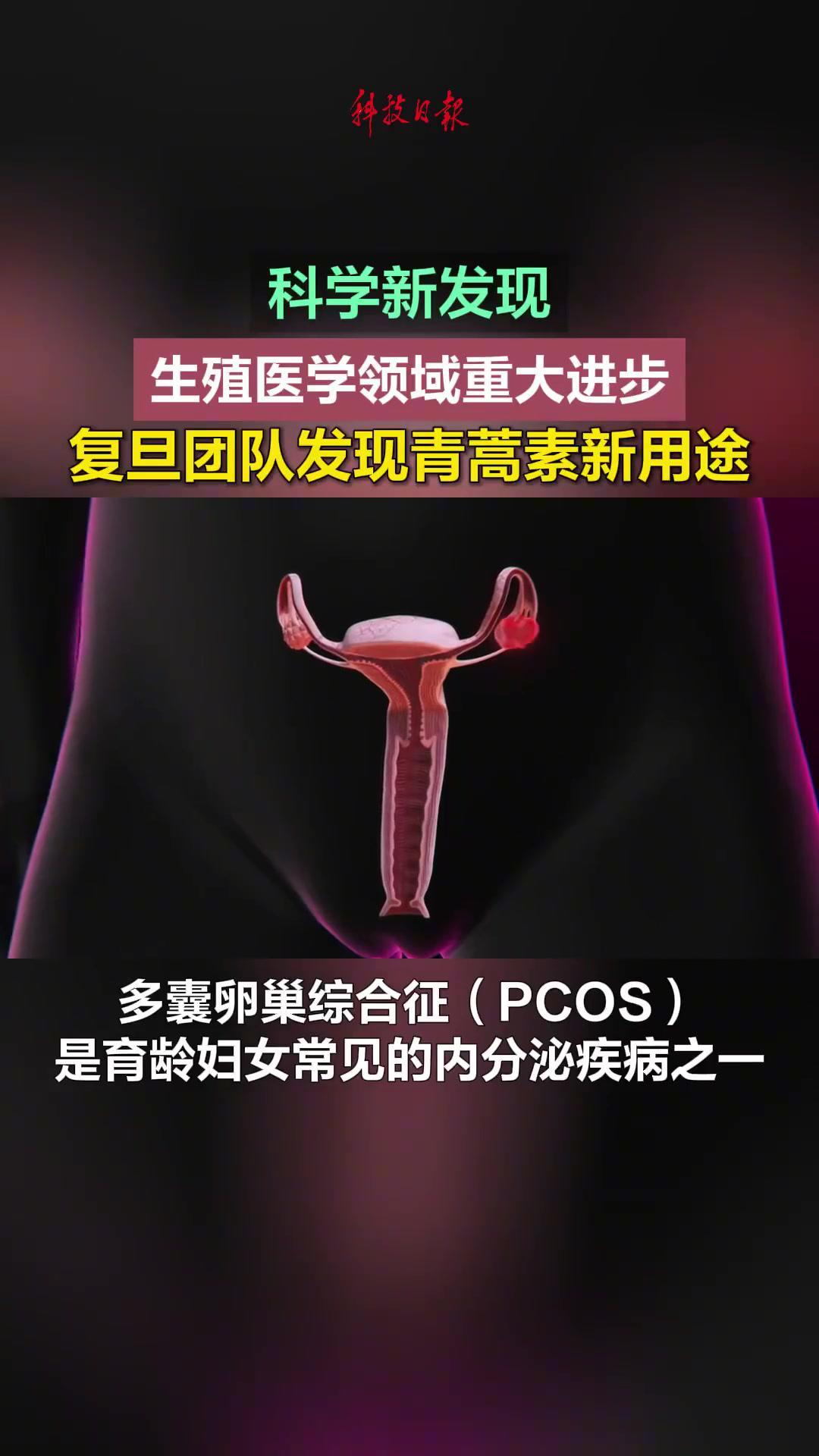复旦团队发现青蒿素新用途