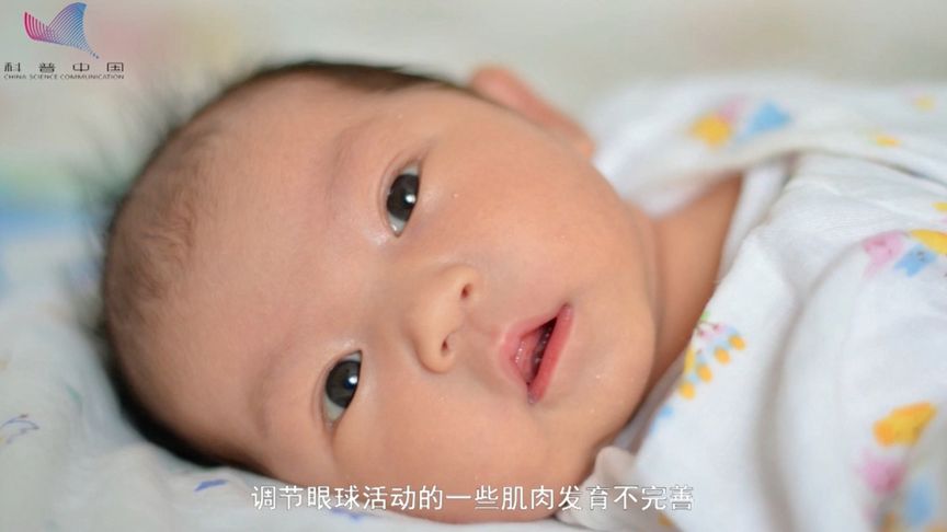 儿童斗鸡眼会消失吗?