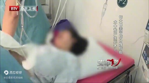 孕妇分娩死胎,剧烈疼痛让她丧失意识,医生:很怕宝宝分娩不完整