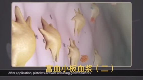 #富血小板血浆 #prp