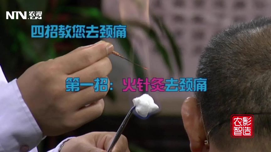 辨清华佗夹脊穴,通过火针灸去除颈椎痛!