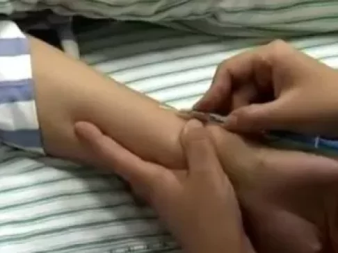 皮内、皮下、肌内注射法