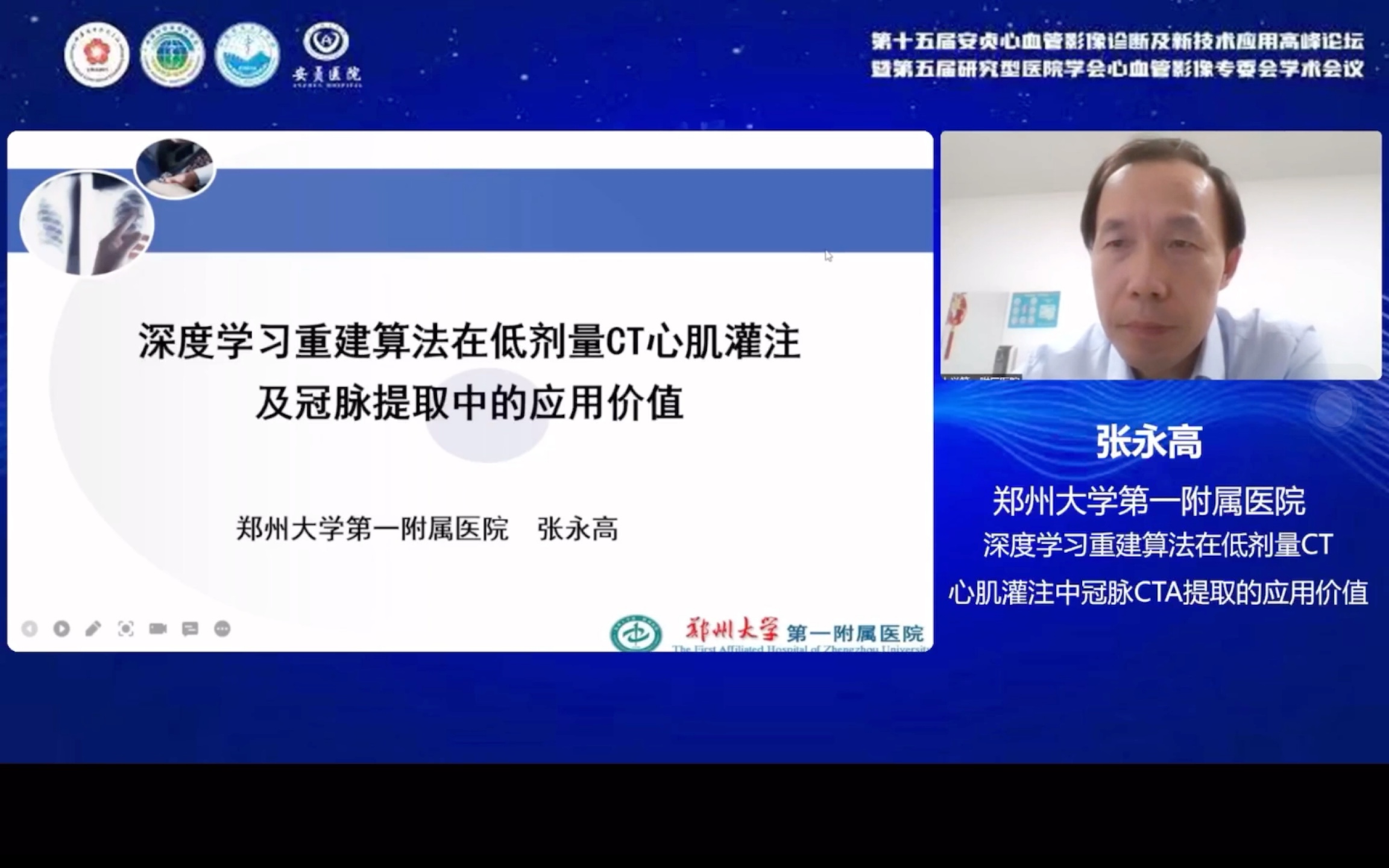深度学习重建算法在低剂量CT心肌灌注中冠脉CTA提取的应用价值—...