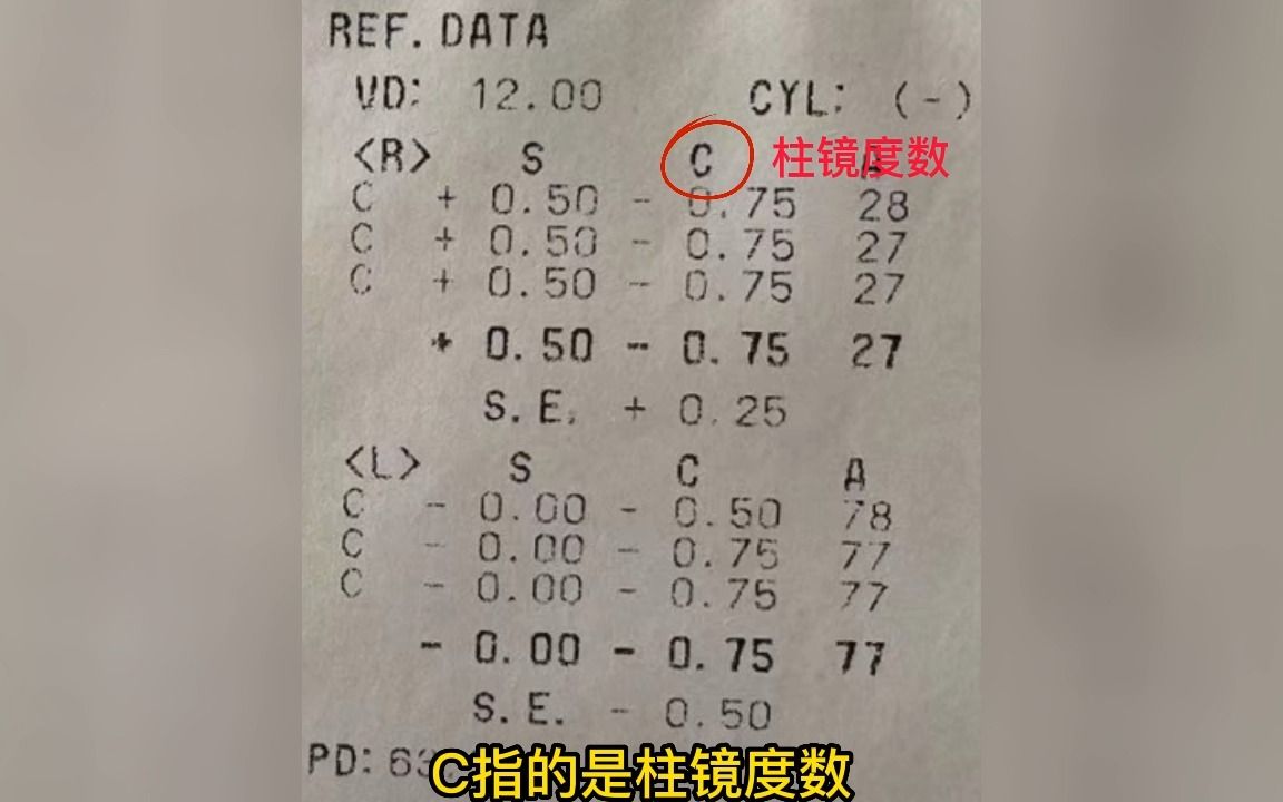 怎么看验光单