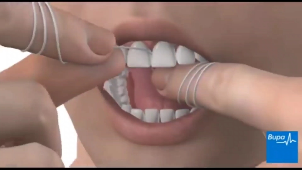 怎么用牙线清洁牙齿,3D演示。